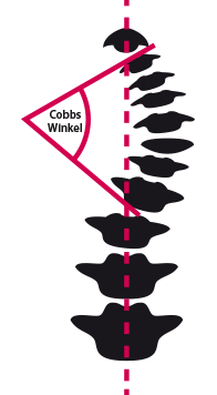 Häufige Fragen zur Wirbelsäule – schwerbehindertenantrag.de
